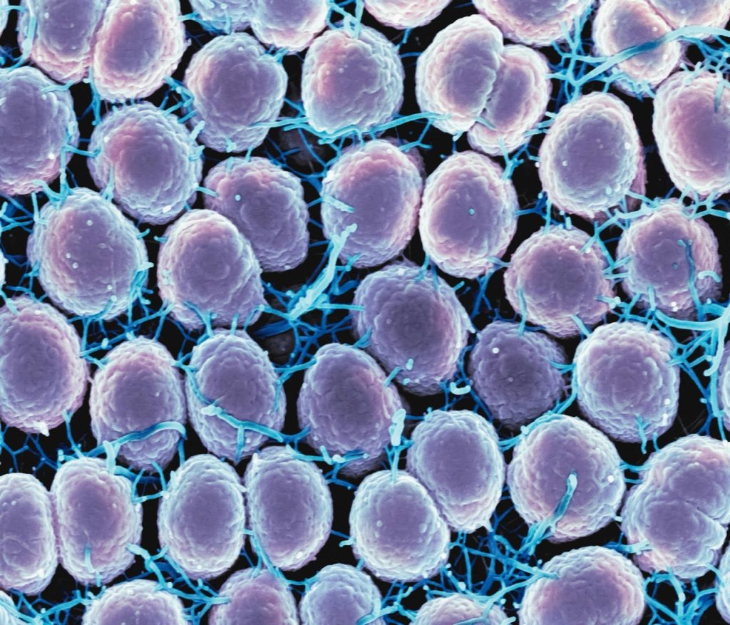 What Are the Different Strains of HPV? High-Risk vs. Low-Risk - STD ...